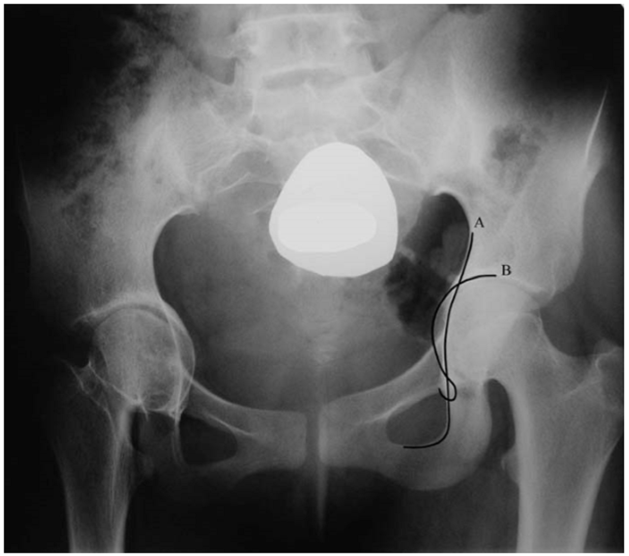 Free Online Systemic Score for Marfans Calculator - OrthoToolKit